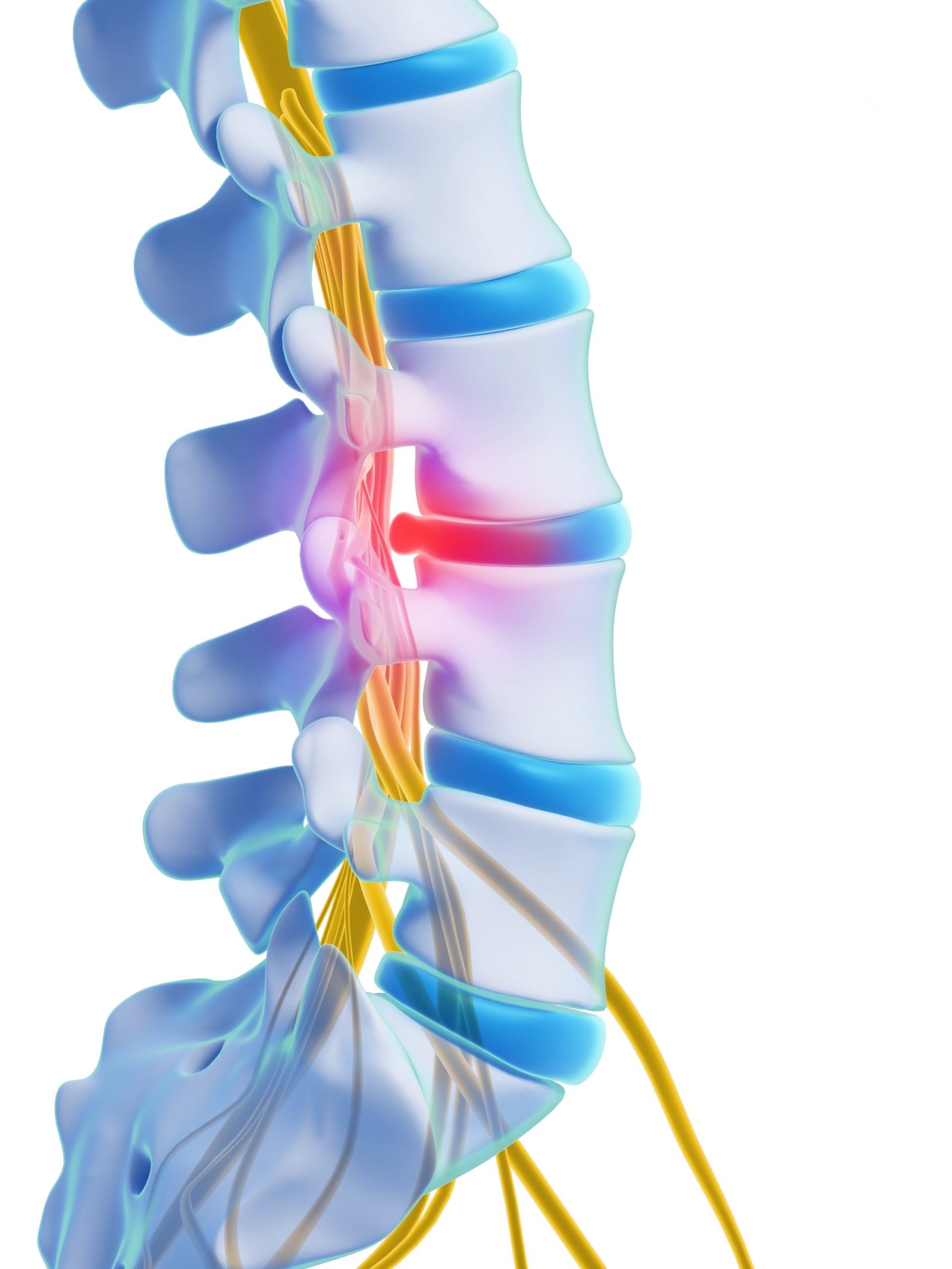 Dynamic Health, Jersey Chiropractor - Chiropractic for Slipped Disc Pain