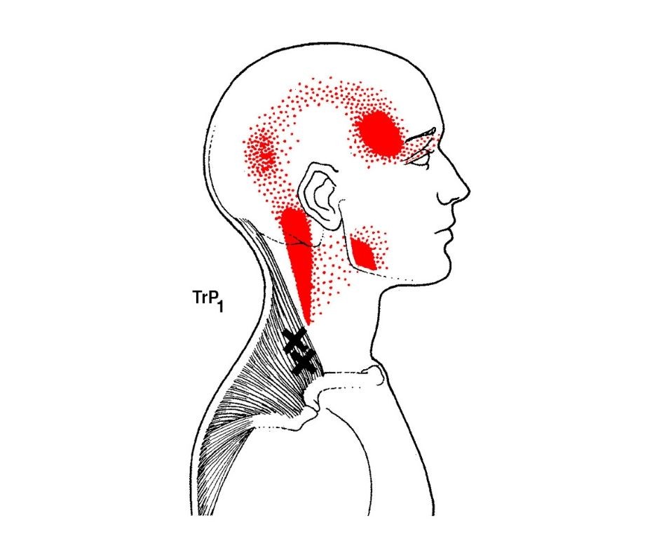 Dynamic Health, Jersey Chiropractor - Foam Roll Angels for Tension ...