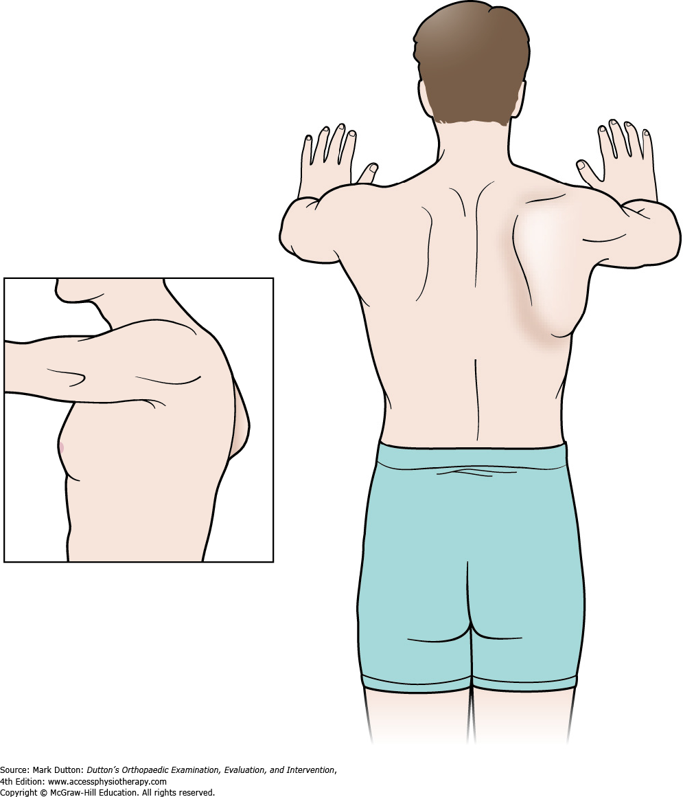 Dynamic Health, Jersey Chiropractor - Wall Push up Test